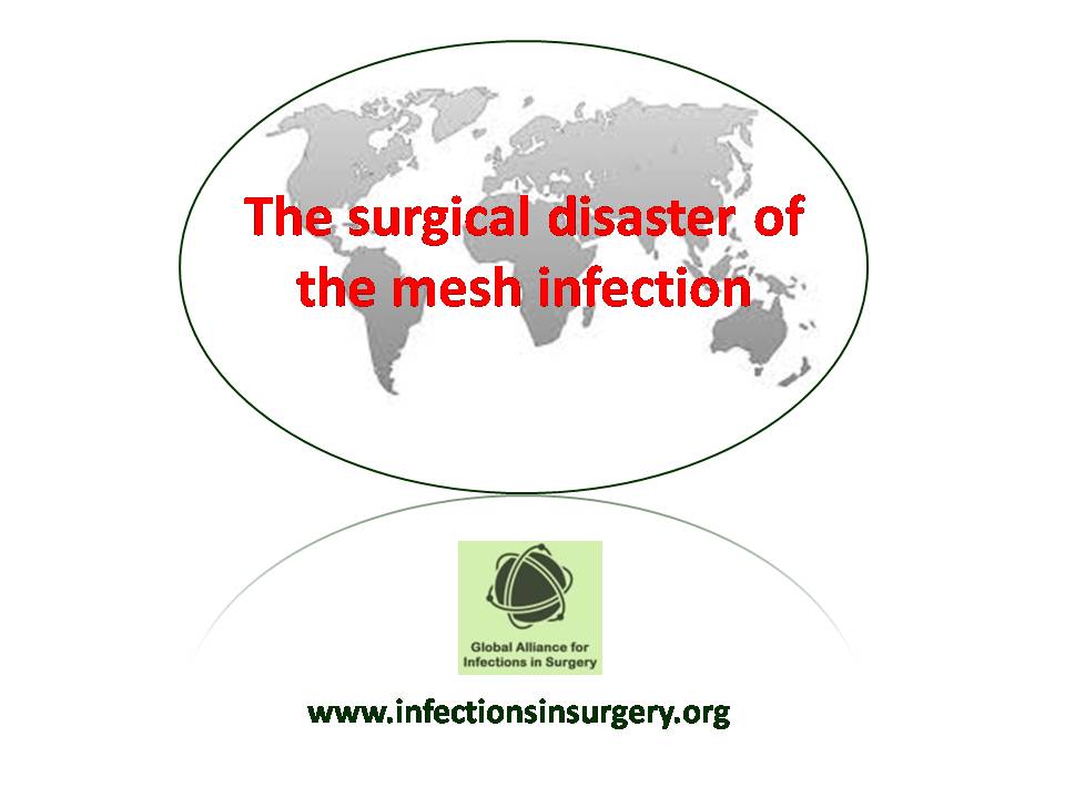 The surgical disaster of the mesh infection – Global Alliance for ...